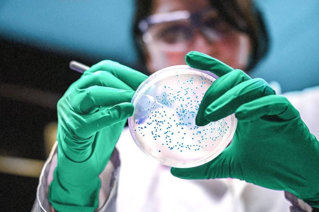 Low Grade Squamous Intraepithelial Lesion (LSIL) - Causes, Symptoms ...